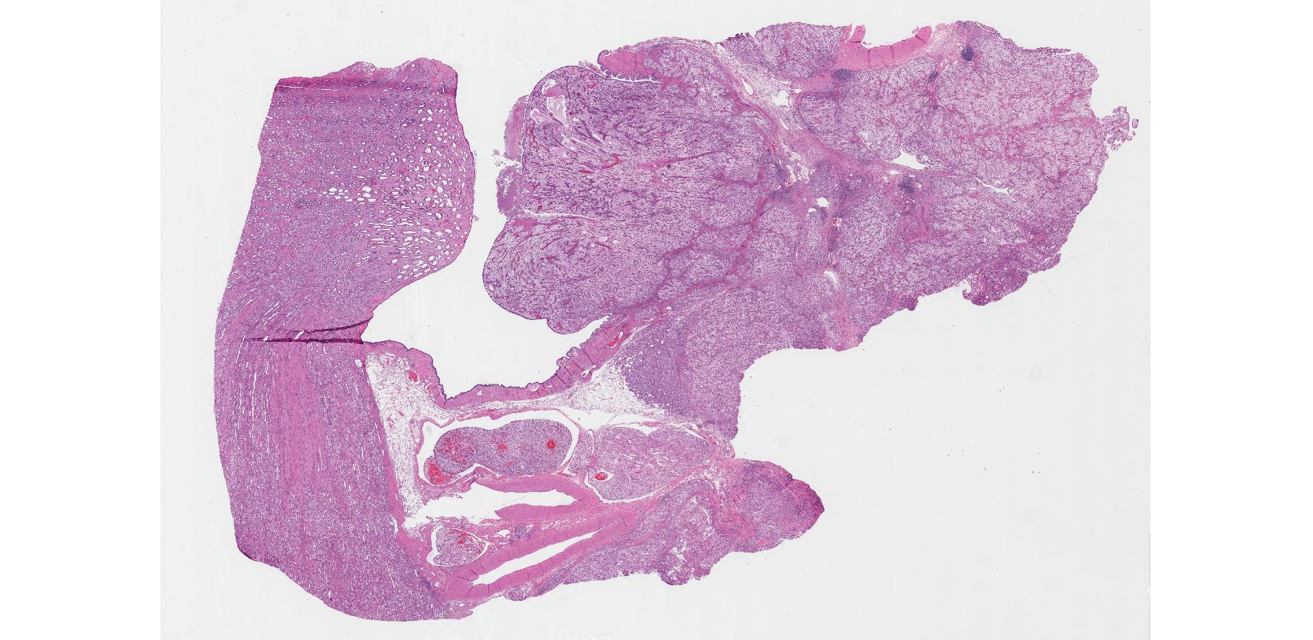 Renal Sinus Histology