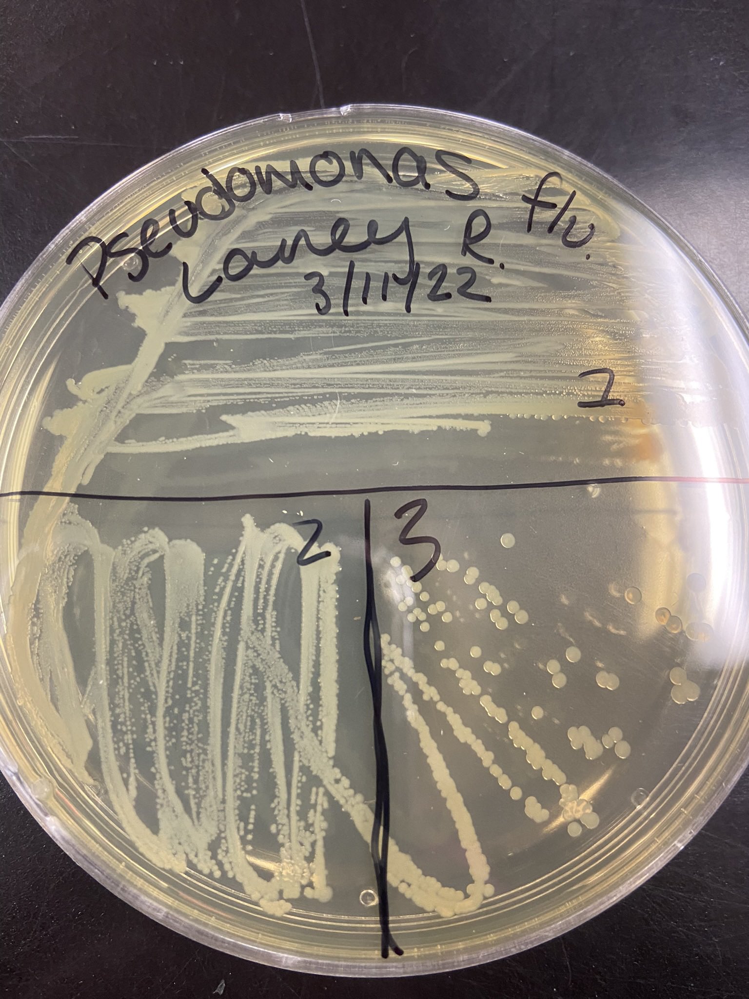 Citrobacter Freundii On Tsa Plate