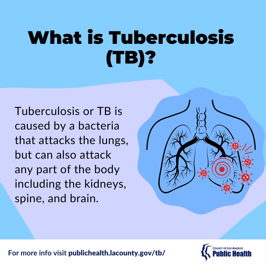 Tuberculosis Lungs Vs Healthy Lungs