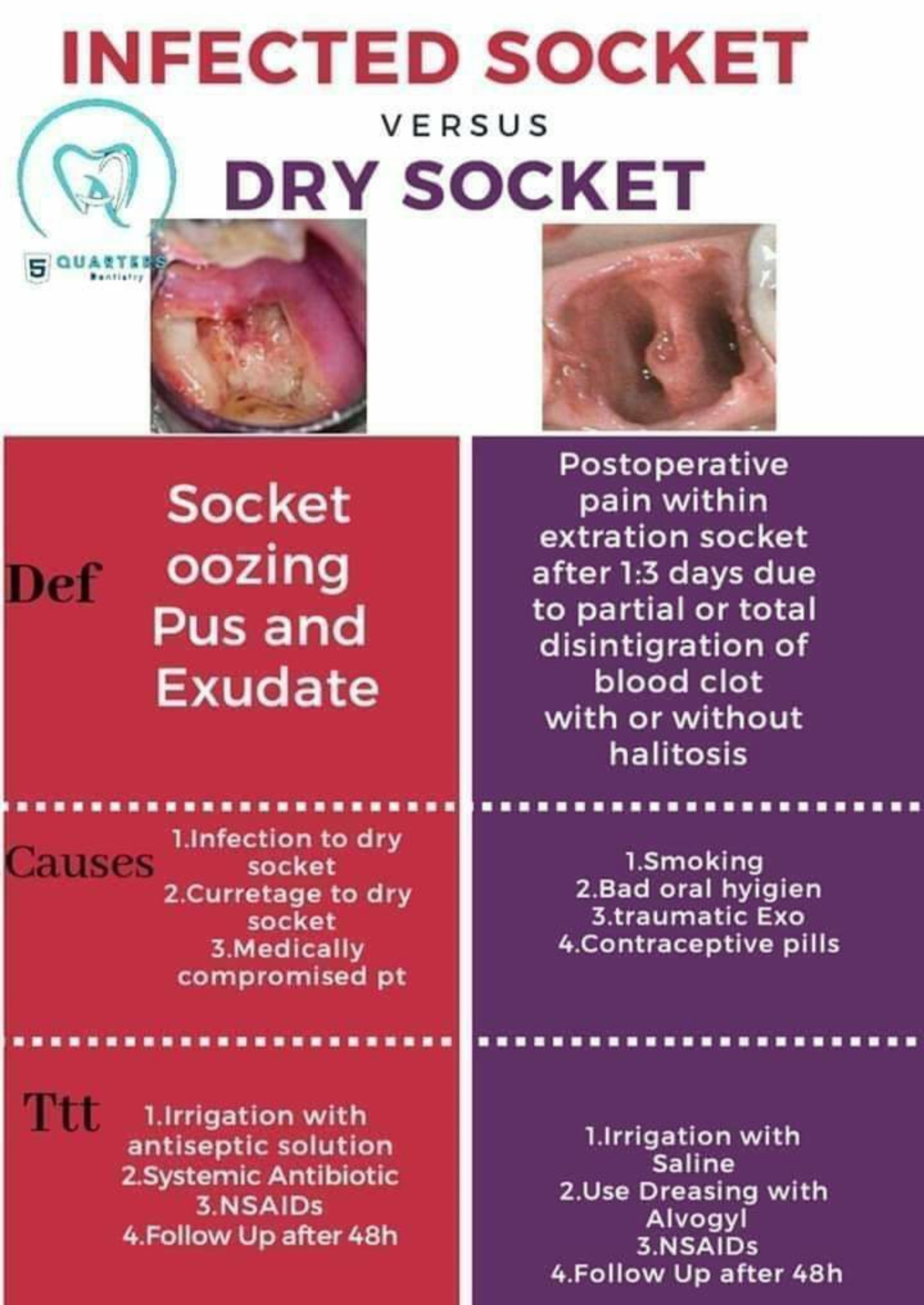 Infected Tooth Socket