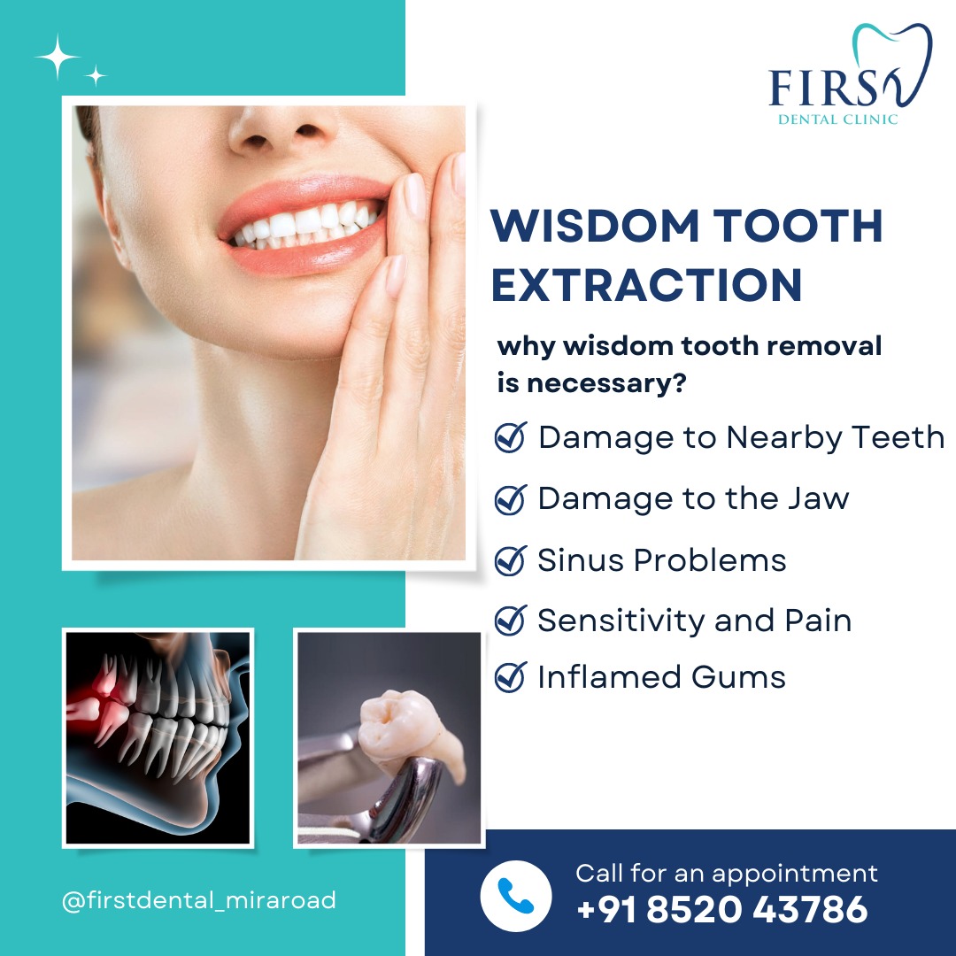 Teeth Extractions 19