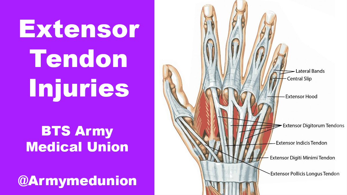 Hand Anatomy Tendons Extensor