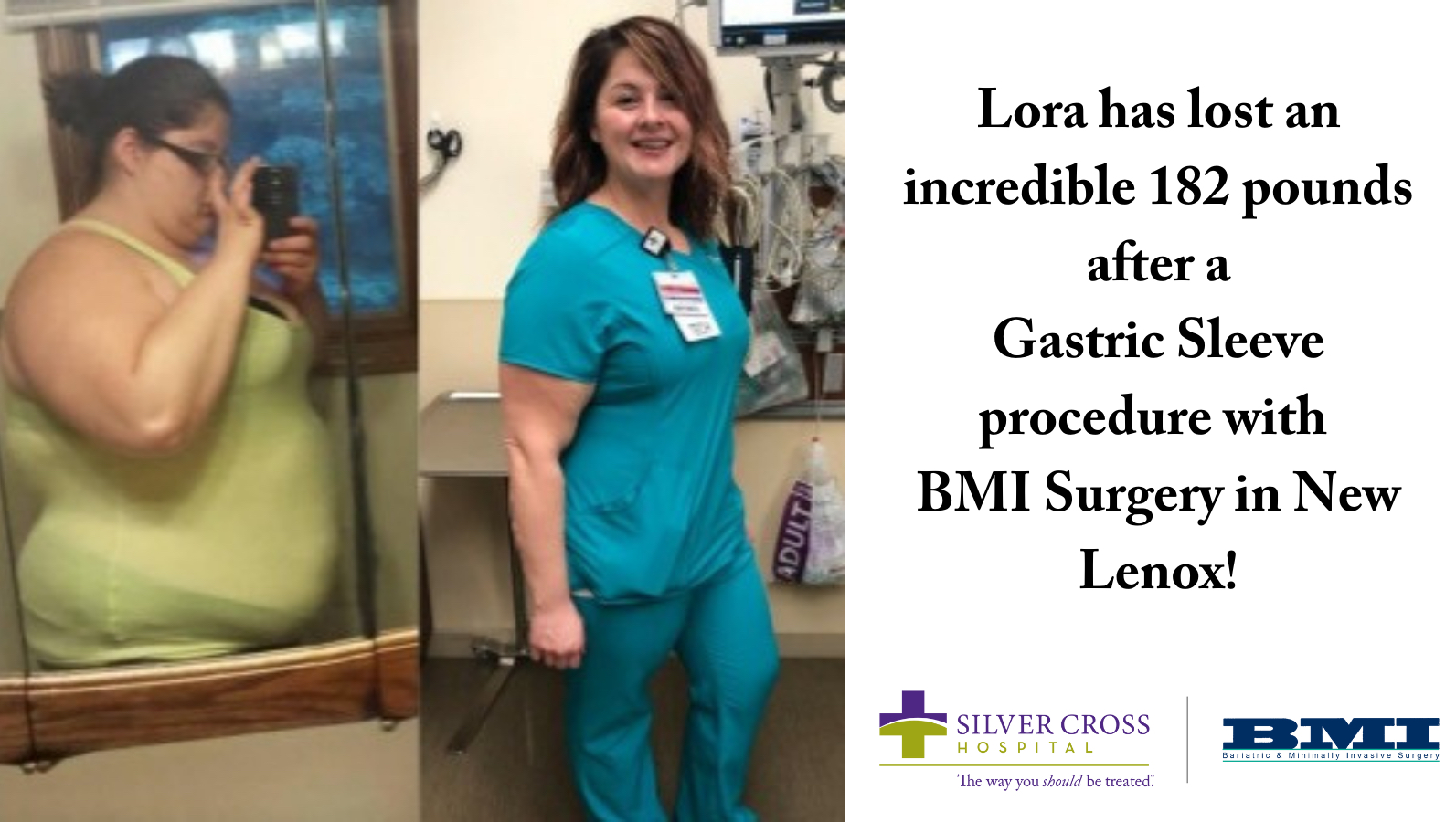 Gastric Sleeve Before And After 2022