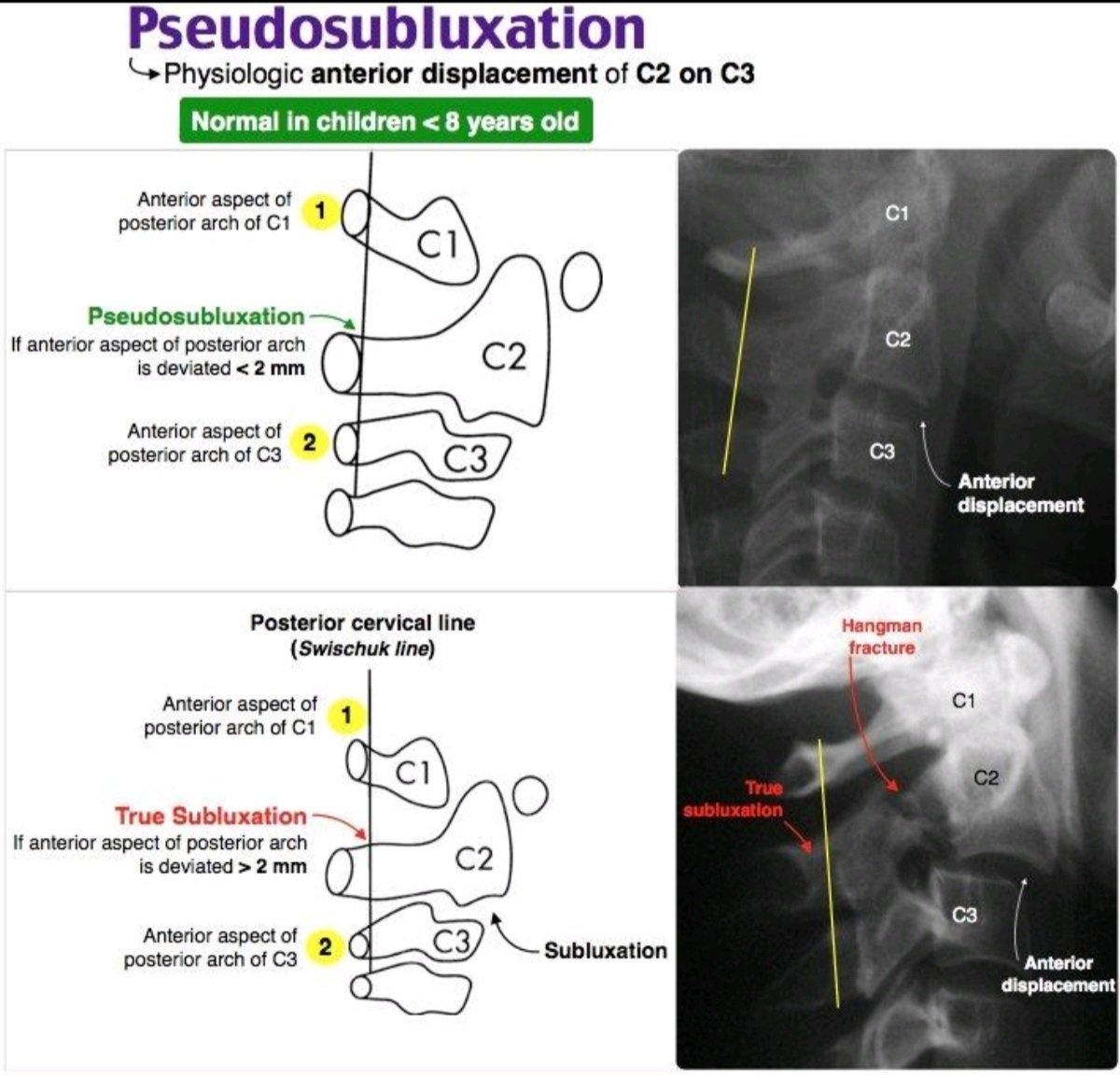 Cervical Line