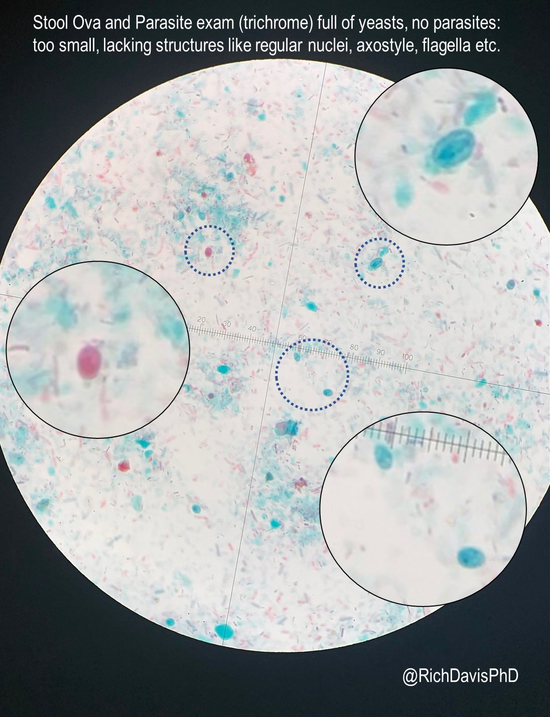 Stool Ova And Parasite