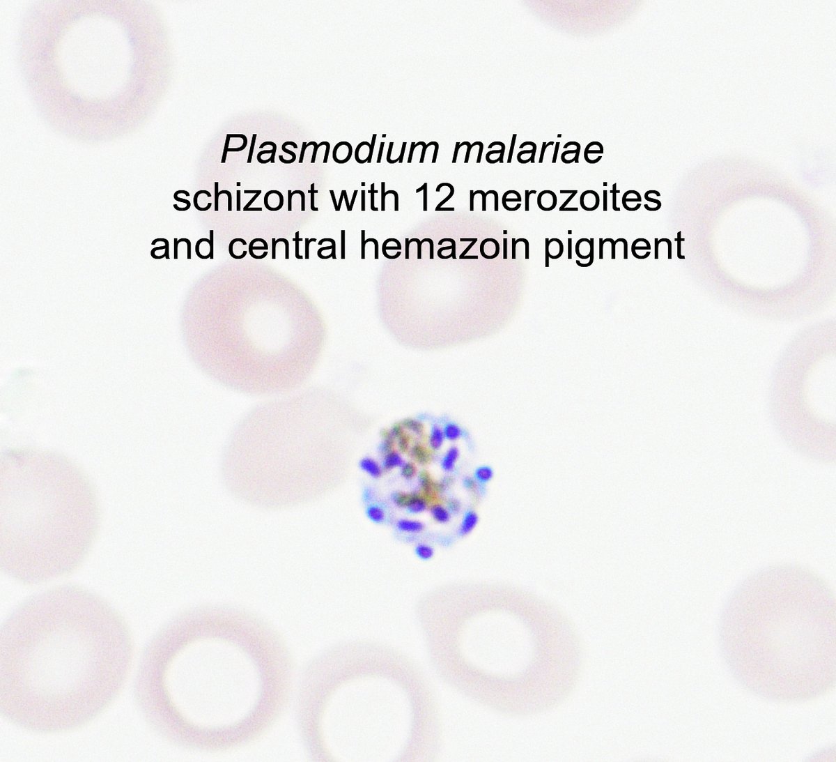 Plasmodium Malariae Trophozoite