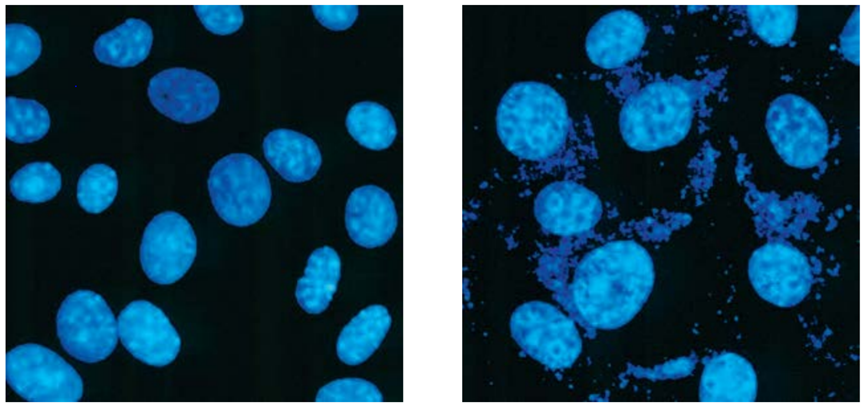 Mycoplasma Dapi