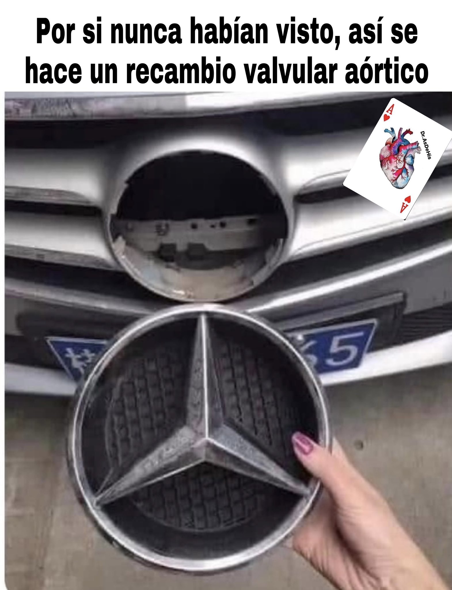 Funny Mercedes Logo Touching But Funny! BMW's Honor To Mercedes Benz