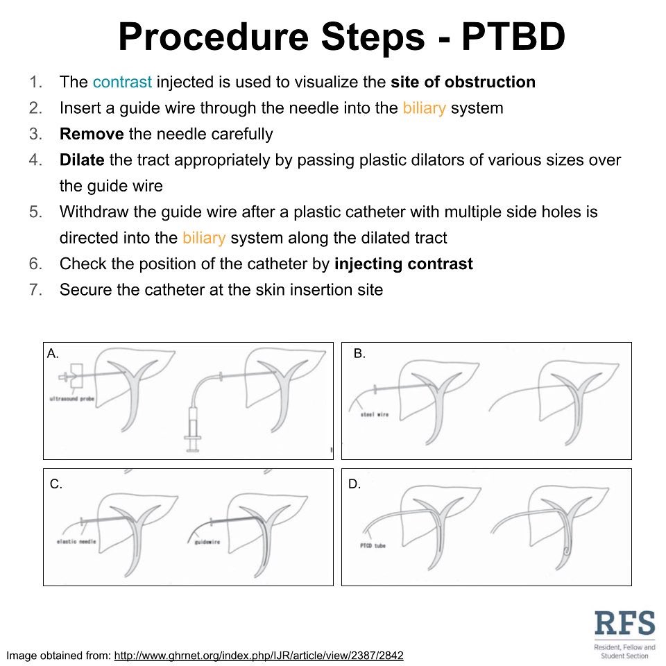 Follow along to learn some quick facts about Percutaneous Transhepatic ...