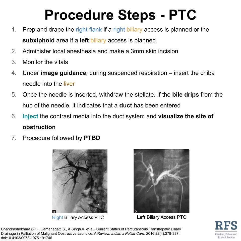 Follow along to learn some quick facts about Percutaneous Transhepatic ...