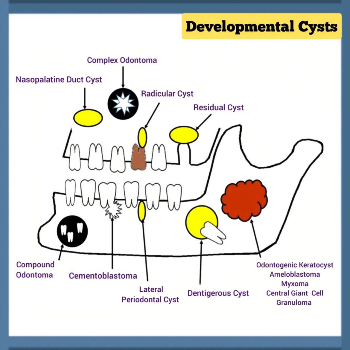 DEVELOPMENTAL CYSTS - Thread from د. هيثم عسيري @_DrHaitham - Rattibha