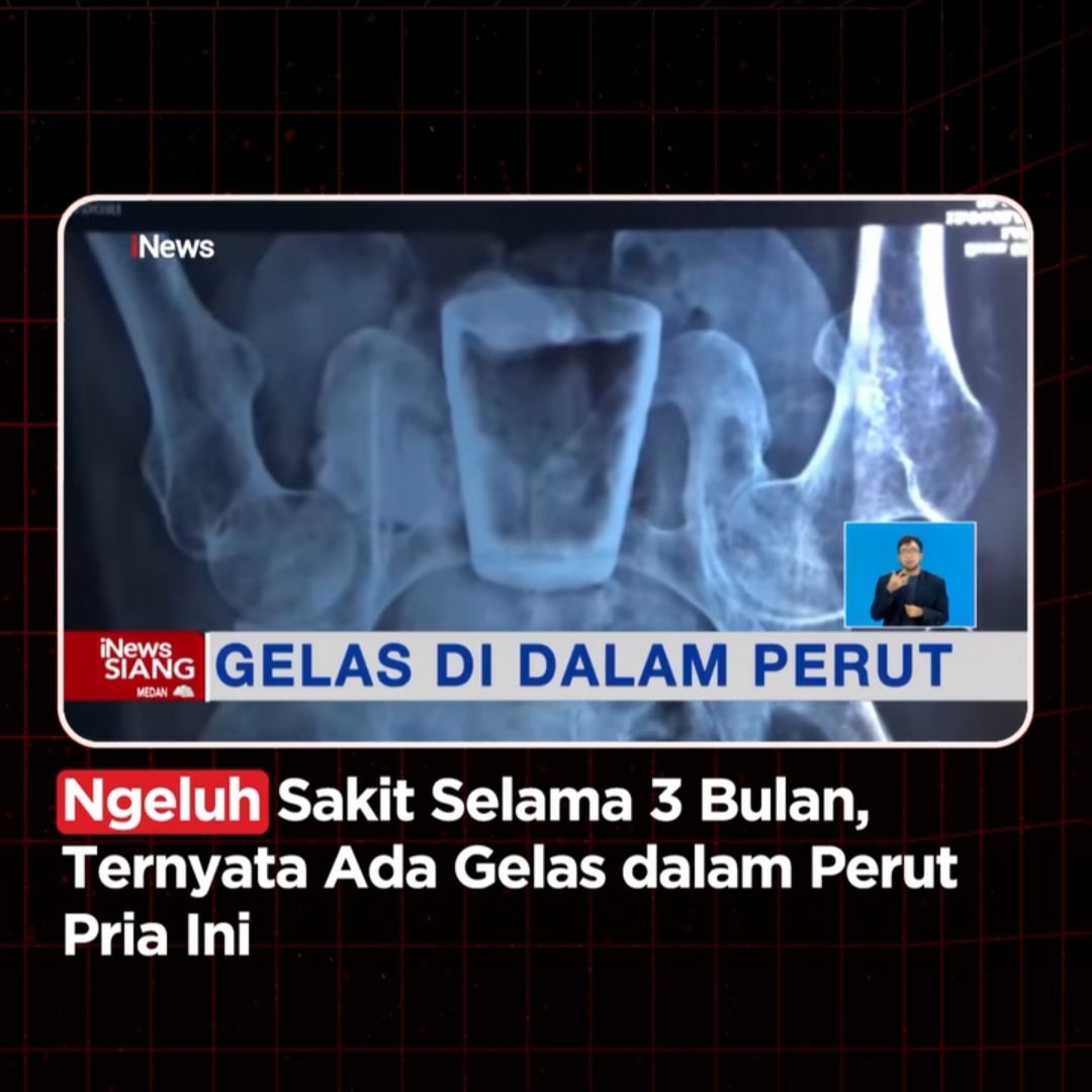 txtdrimedia on Twitter: "https://t.co/F1vFhZup1u" / Twitter