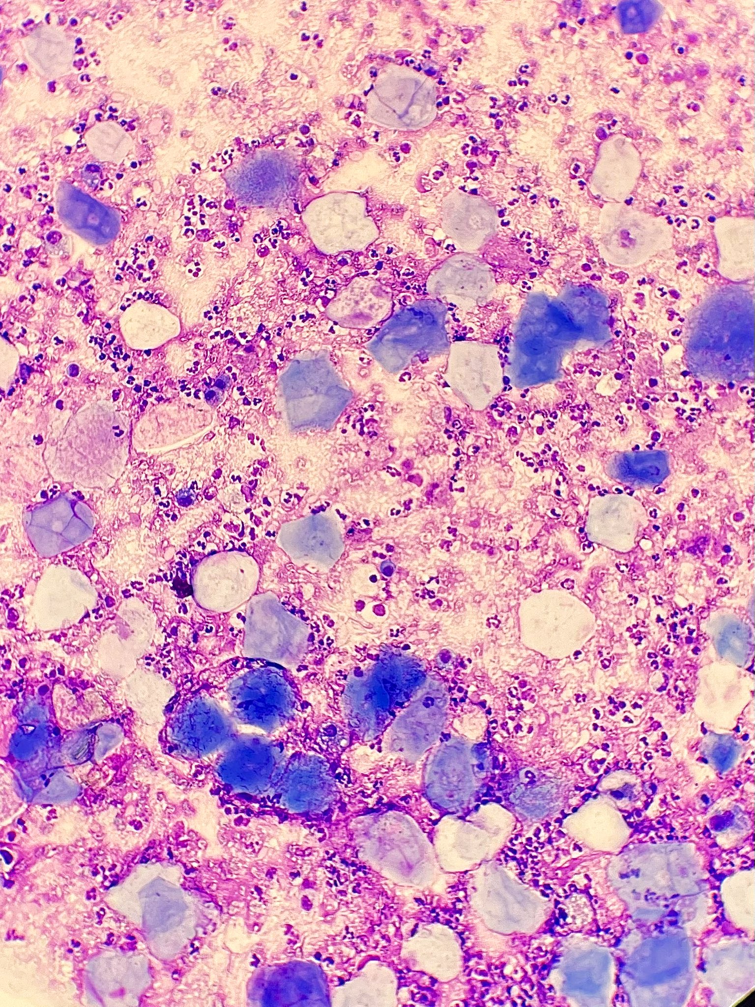 Epidermal Inclusion Cyst Cytology Dog