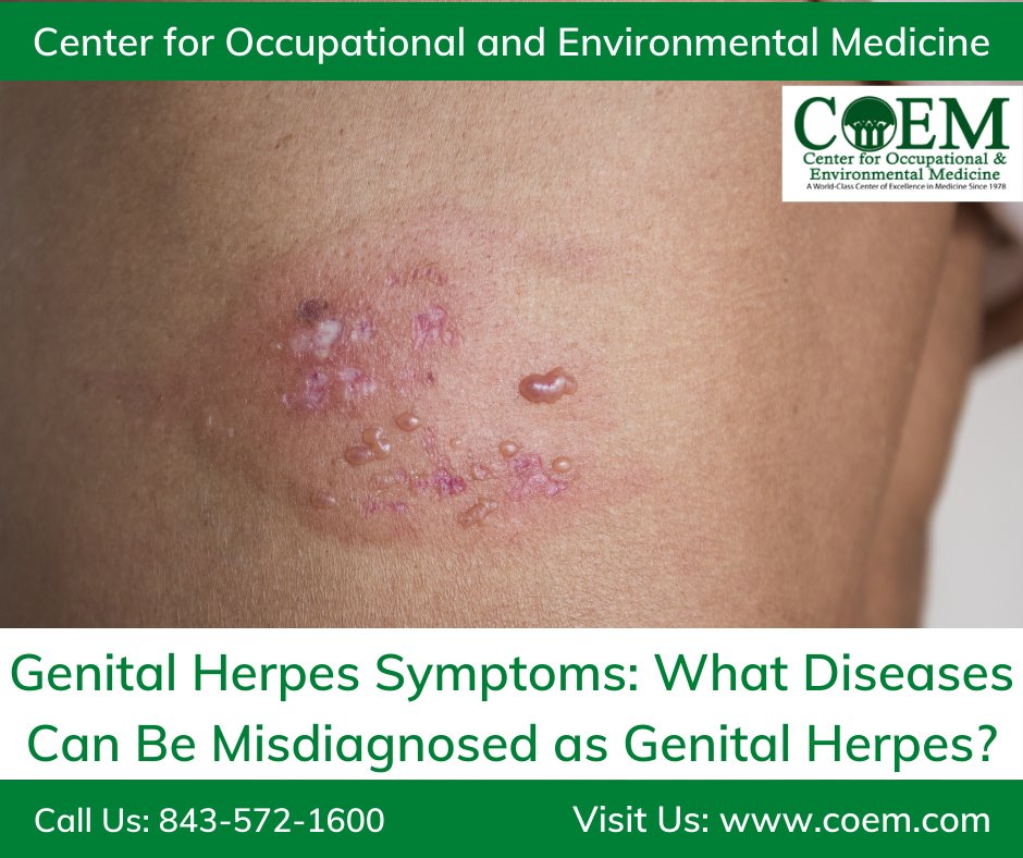Herpes Symptoms In Women PPT Genital Herpes: Symptoms, Causes,