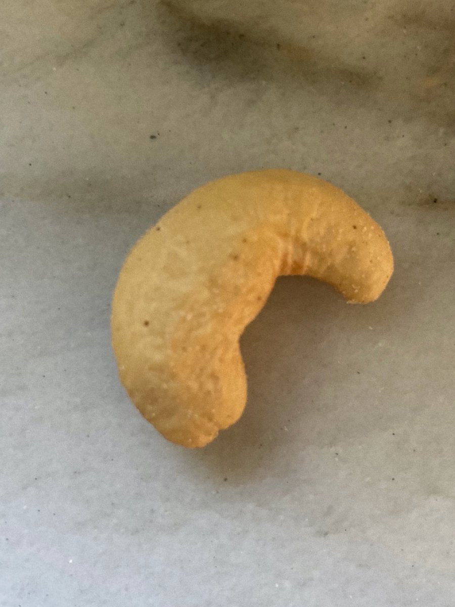 If the Cashew Nut sign should make you worry about venous sinus ...