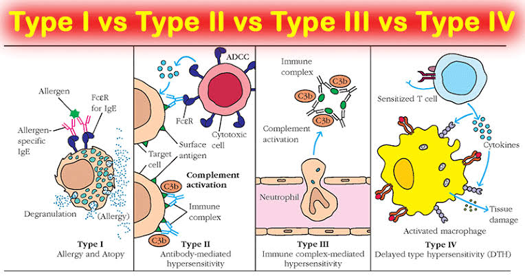 Medical Mnemonics Types Of Hypersensitivity Reactions Hypersensitivity