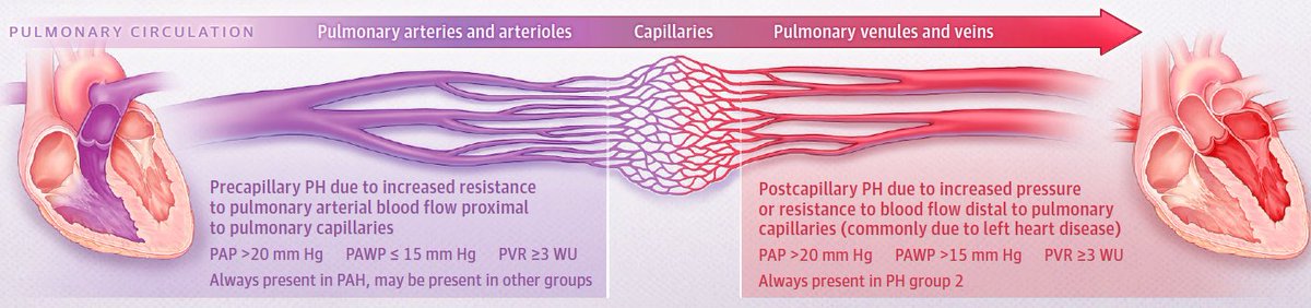 🆕 HIPERTENSIÓN ARTERIAL PULMONAR (HAP) 🫁 📌 Definición y clasificación 📌 ...