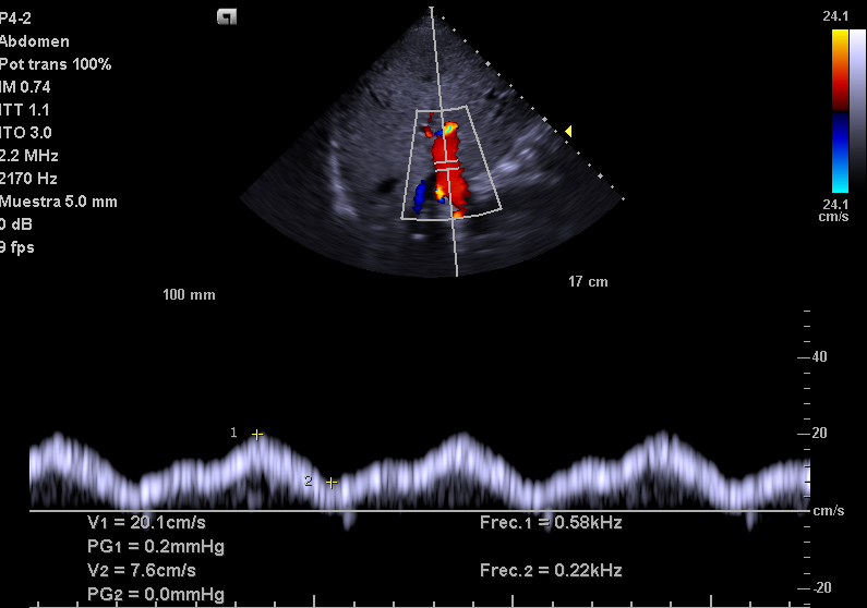 Asymptomatic thin, healthy and young medical resident Scanned as part ...