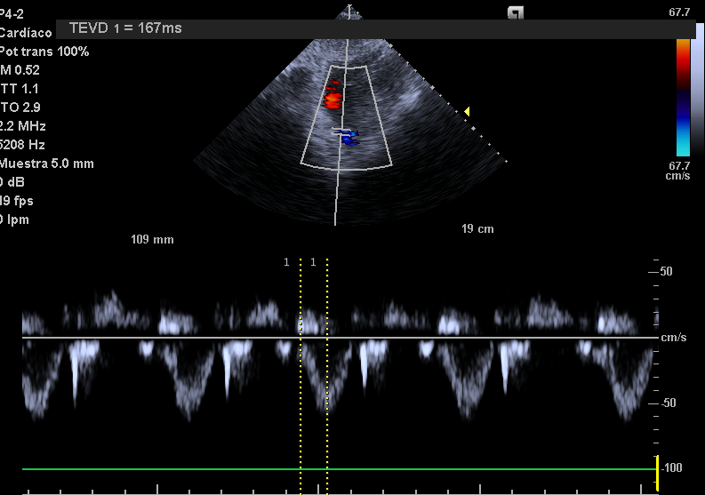 Asymptomatic thin, healthy and young medical resident Scanned as part ...