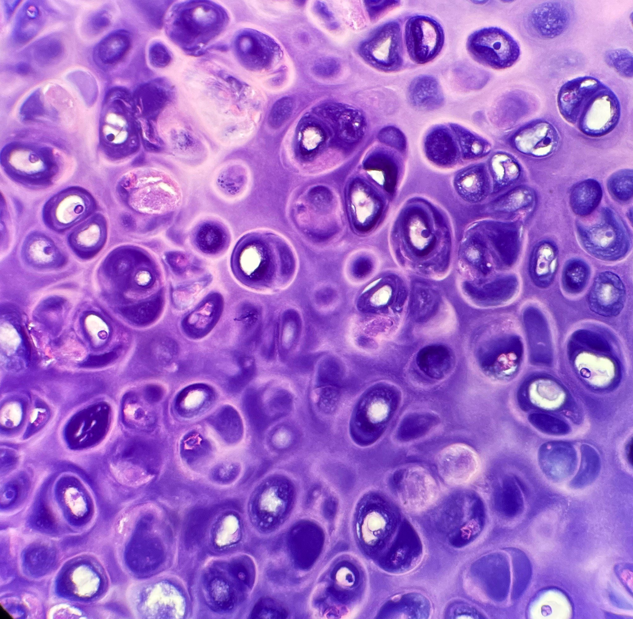 Hyaline Cartilage Under Microscope