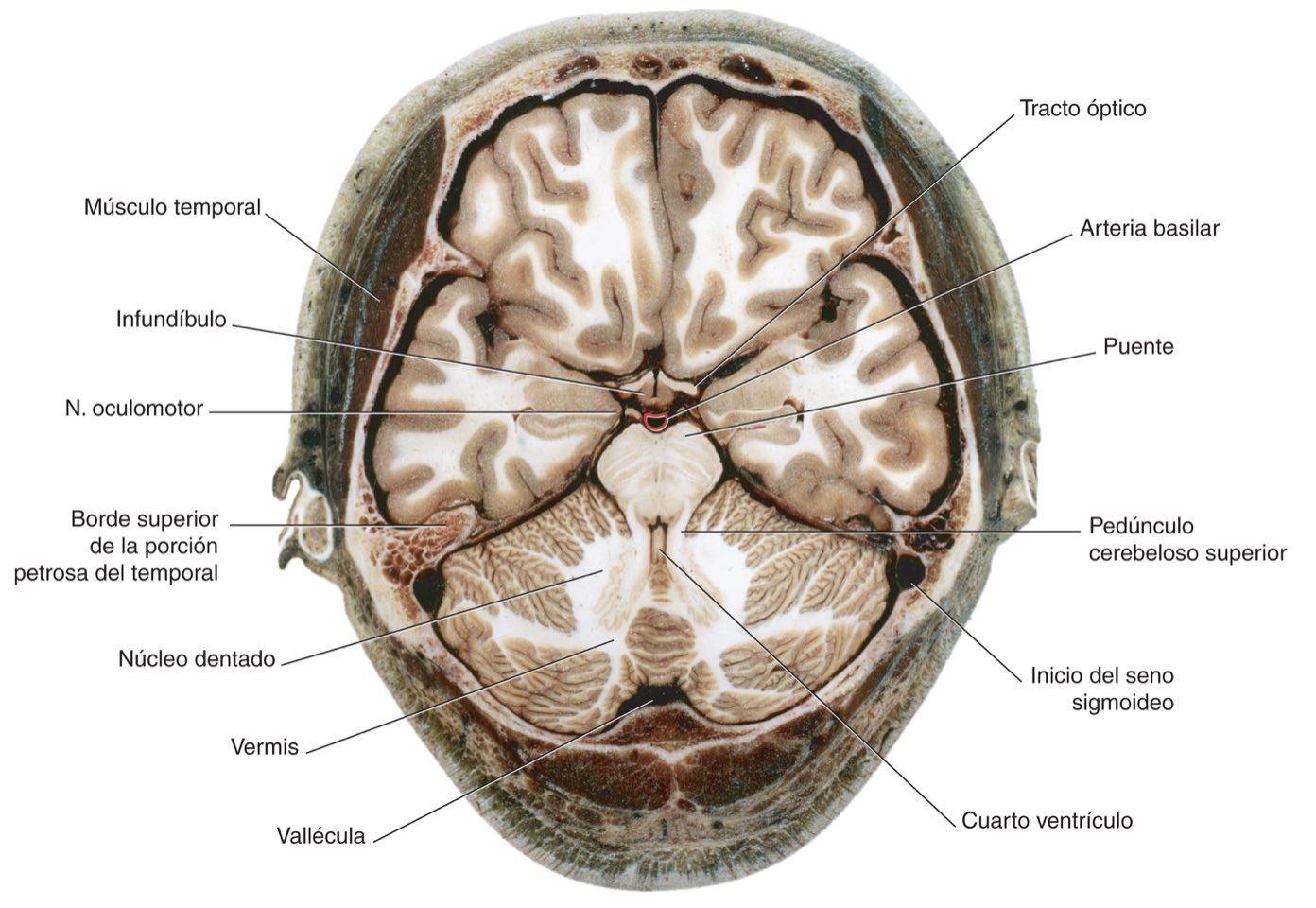 Anatomía De Cortes Cerebrales