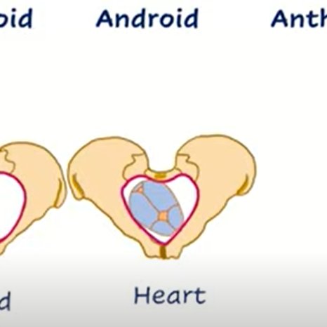 Female Pelvis and Its importance Important read for women who want to ...