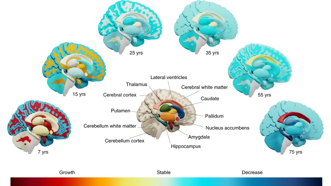 Shrinkage Of Cerebellum