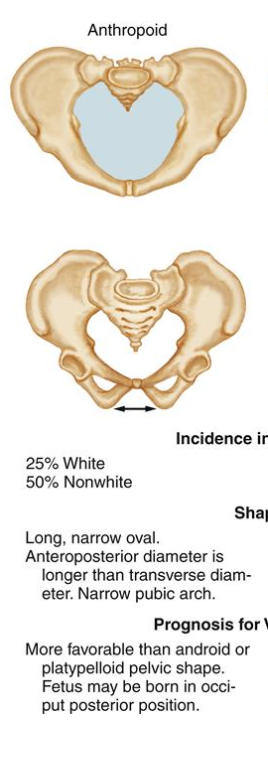 Female Pelvis and Its importance Important read for women who want to ...