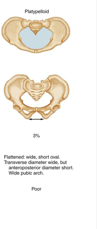 Female Pelvis and Its importance Important read for women who want to ...