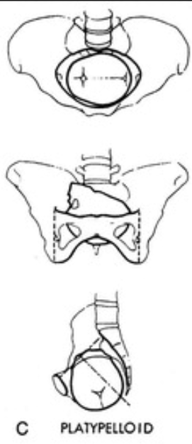 Female Pelvis and Its importance Important read for women who want to ...