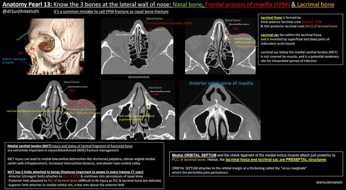 Frontal Process Of Maxilla