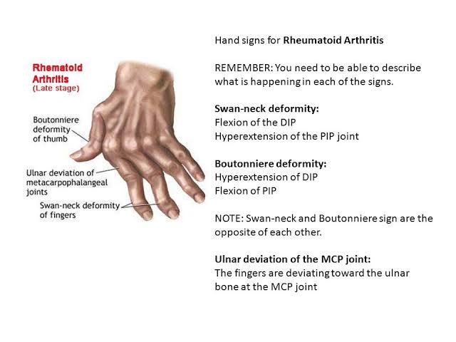 Boutonniere And Swan Neck Finger