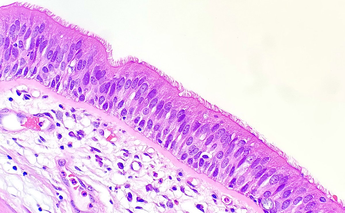 Pseudostratified Columnar Epithelium Slide