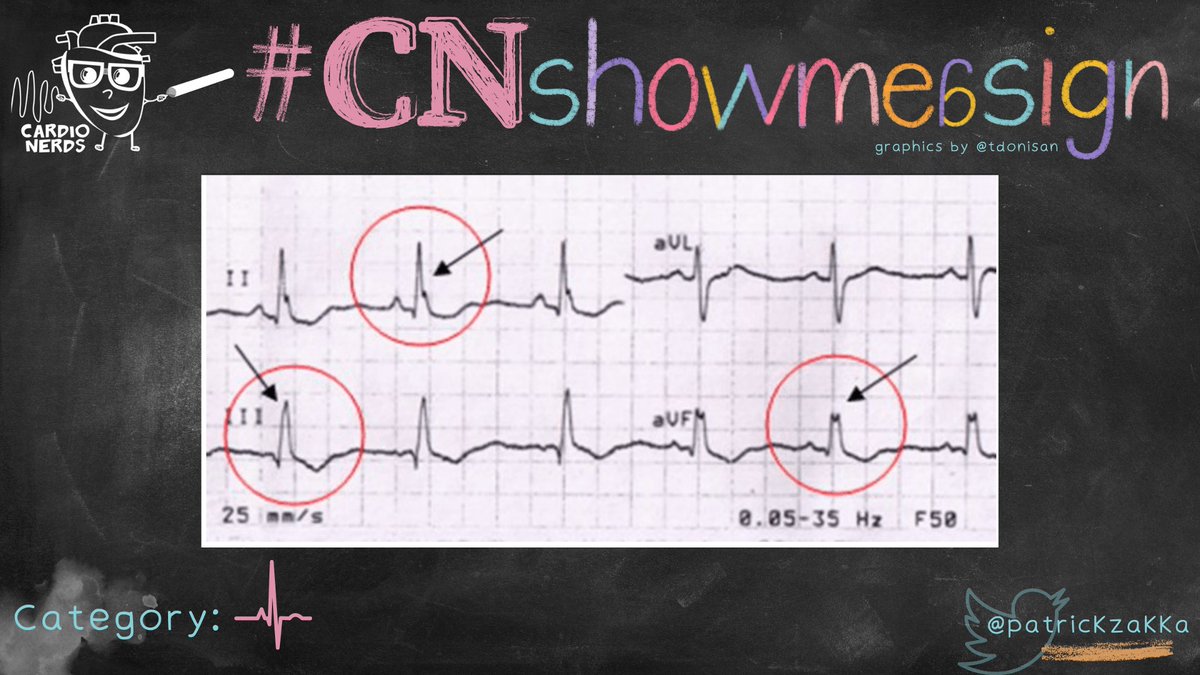 Patrick Zakka, MD's Threads – Thread Reader App