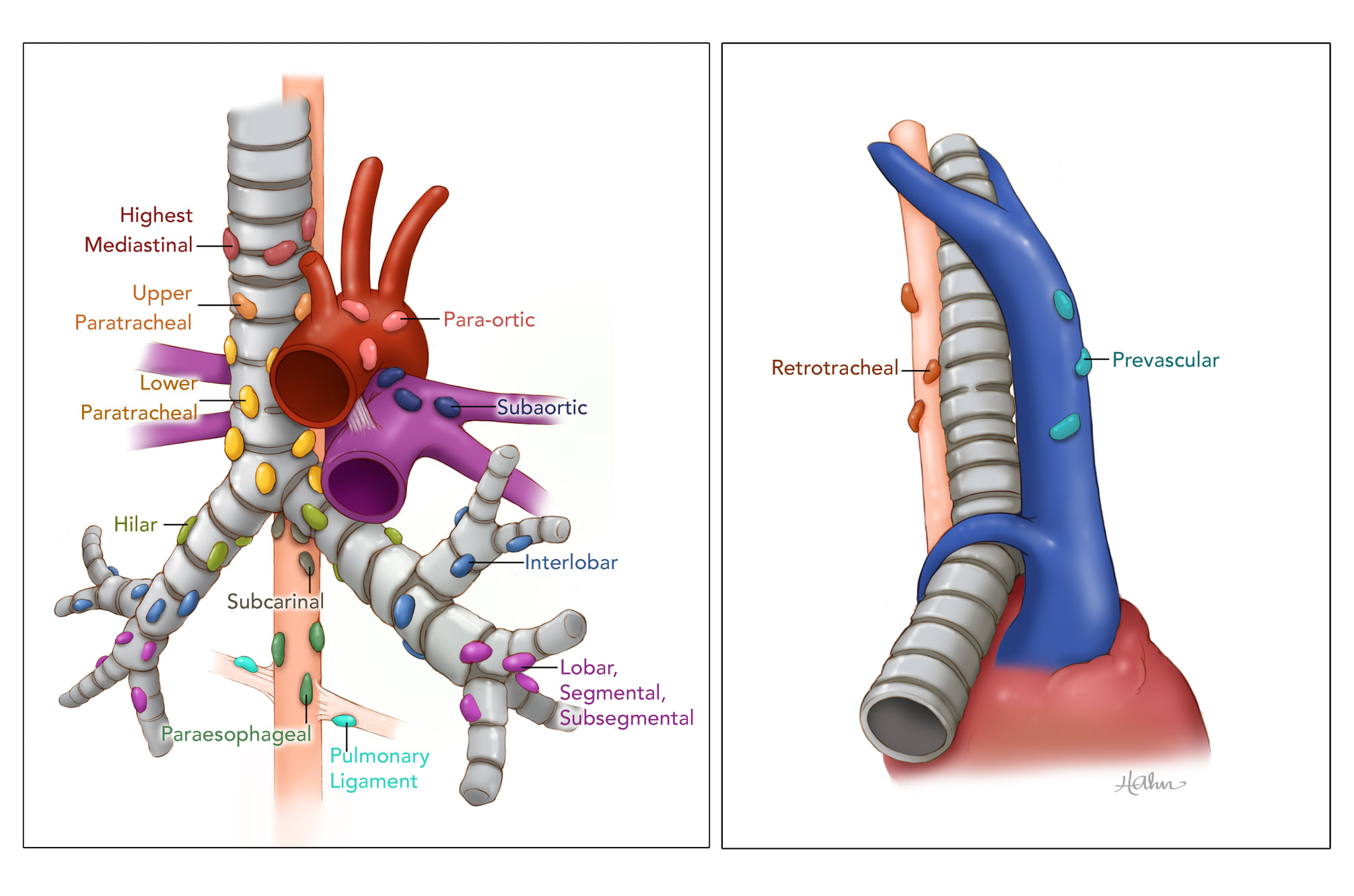 Paratracheal Lymph Nodes