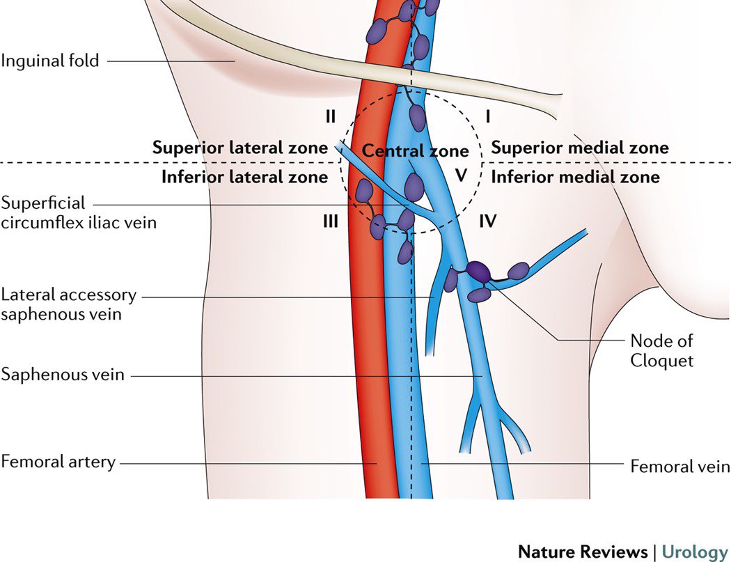 Inguinal Nodes