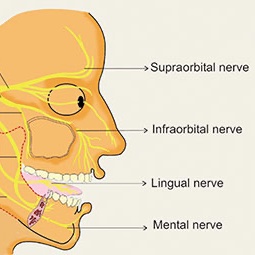اليوم نتكلم عن Canine Space Infection او تسمى Infraorbital space او ...