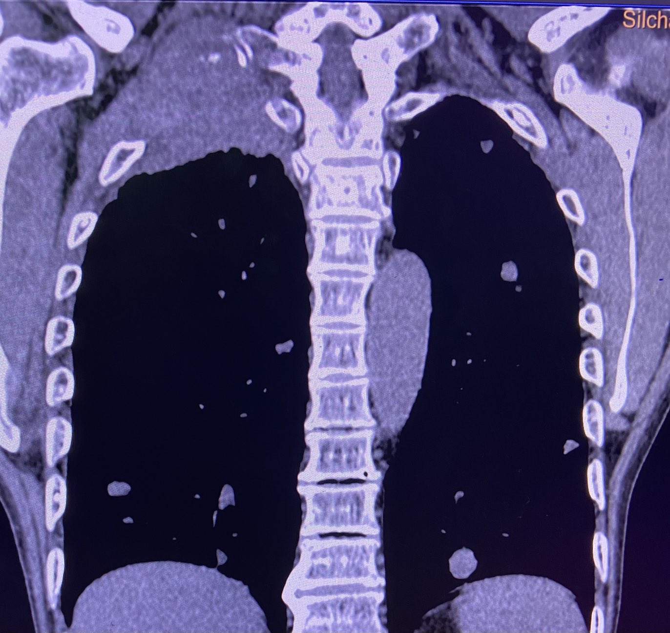 Radrounds Radiology Network Radrounds Twitter