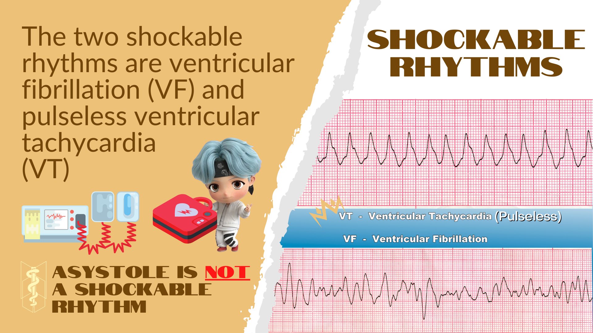 Pulseless Ventricular Tachycardia Ventricular Tachycardia