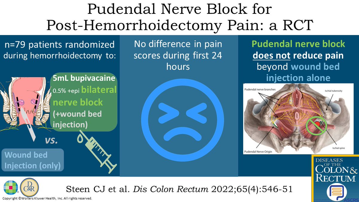 Bilateral Pudendal Nerve Block