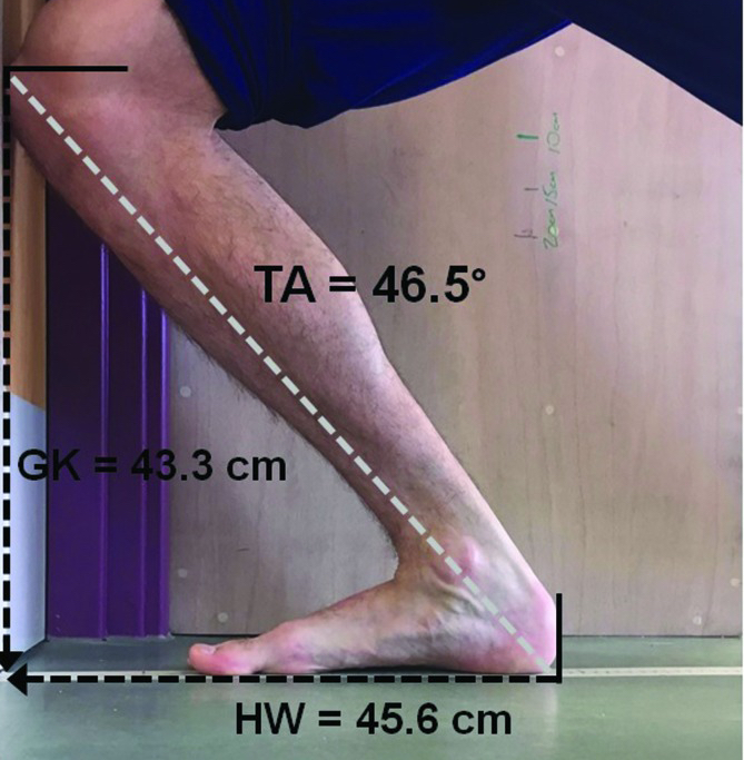 Ankle Dorsiflexion Test