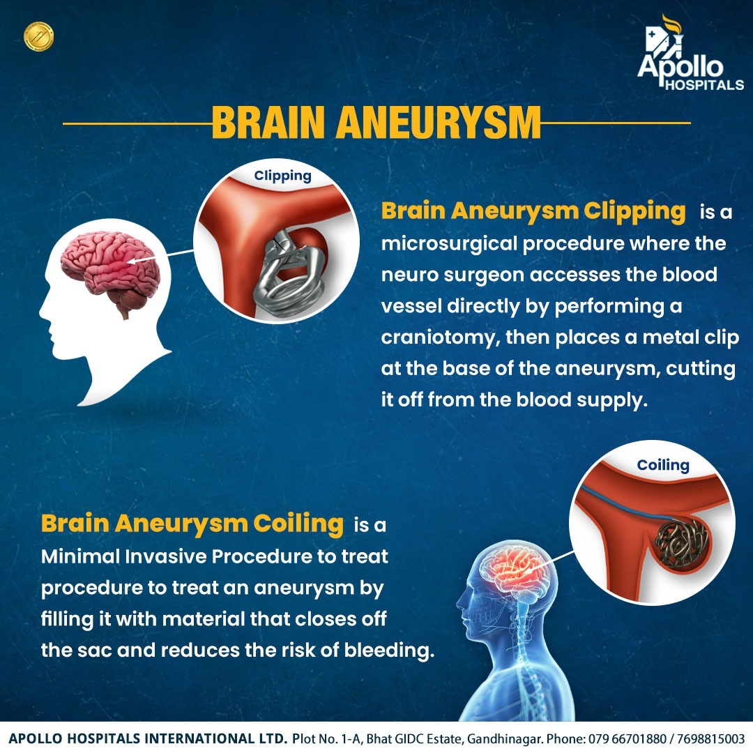Cerebral Aneurysm Clip