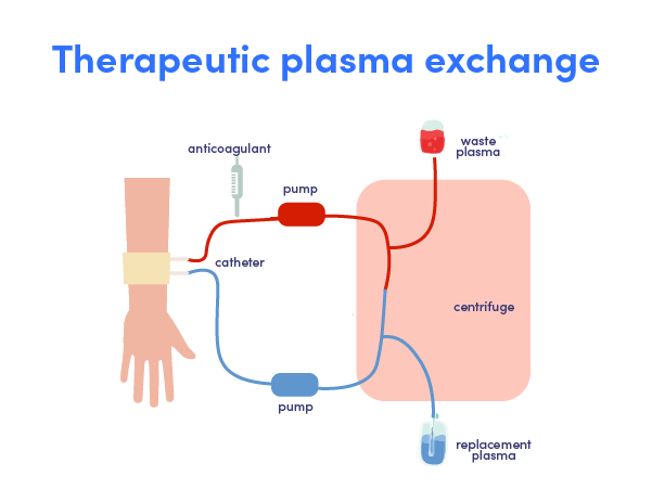 Plasma Exchange