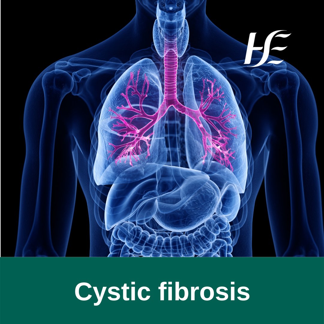 Cystic Fibrosis Lungs Diagram