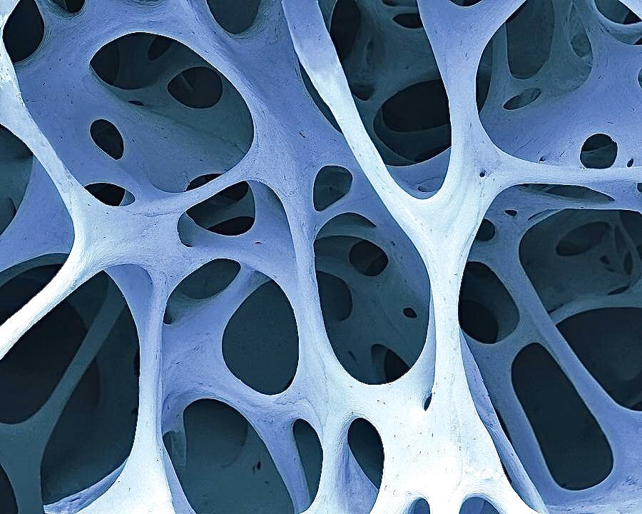 Bone Under Microscope