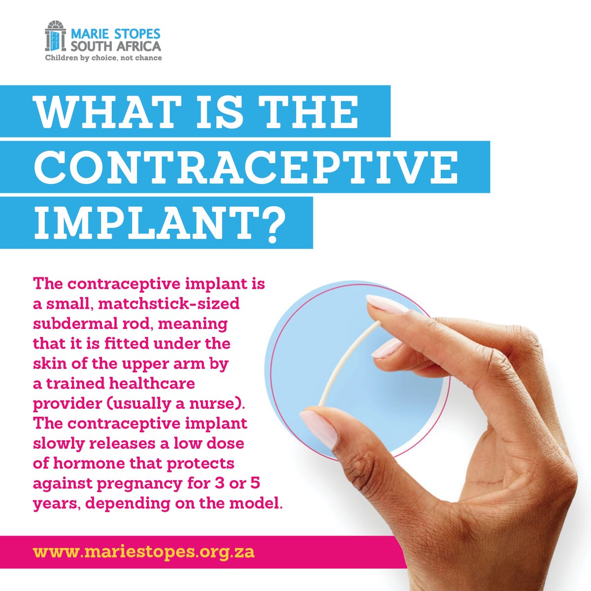 Subdermal Implants Contraceptive