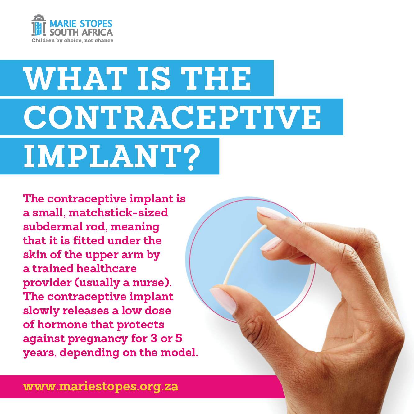 Contraceptive Implants