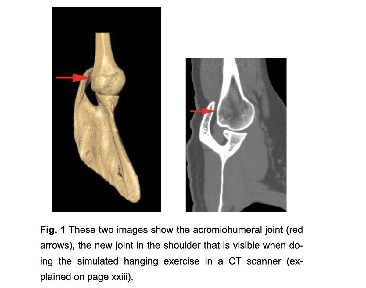 THE POWER OF DEAD HANGS: Hanging from an overhead bar has become ...