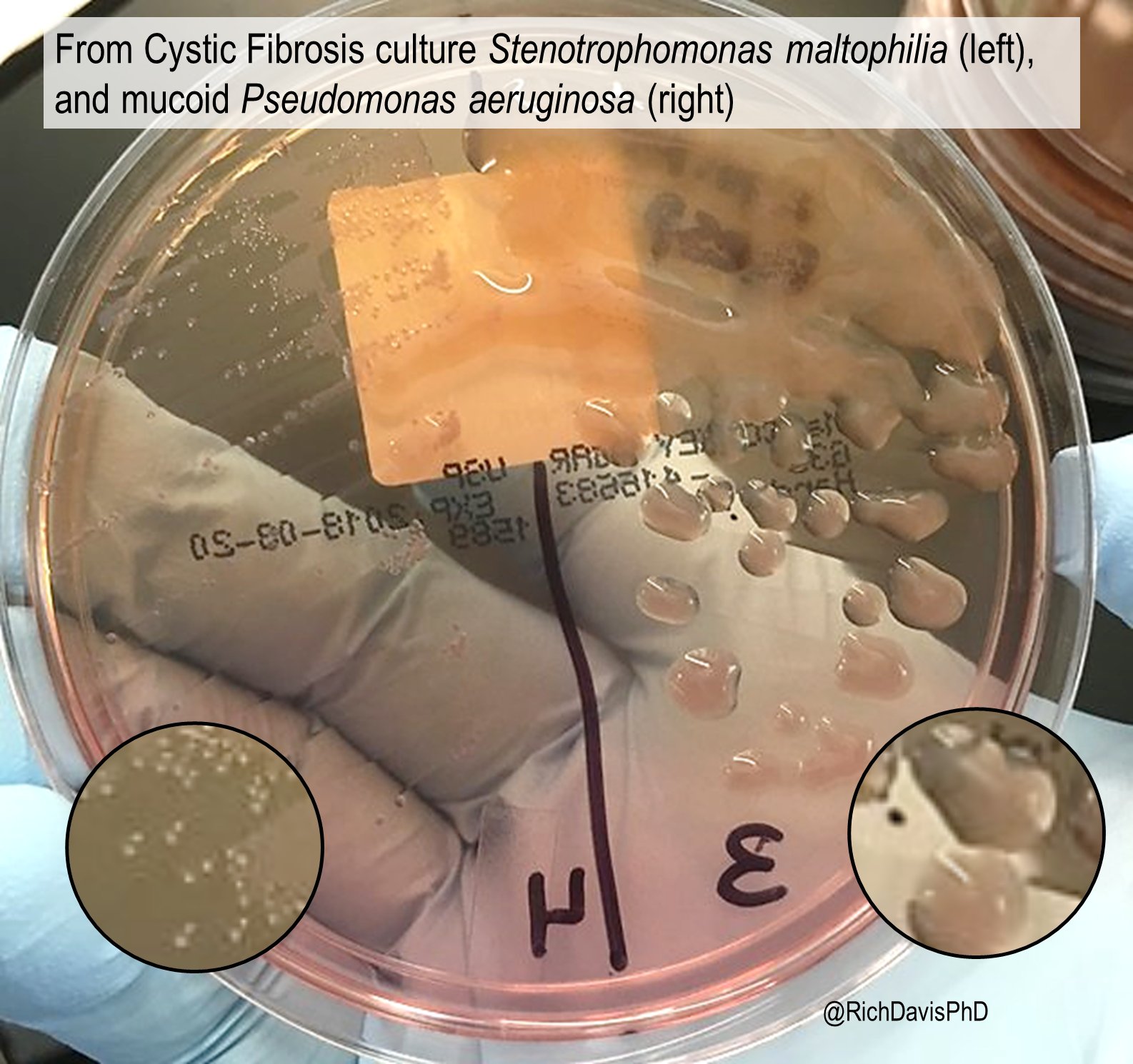 Pseudomonas Aeruginosa Culture