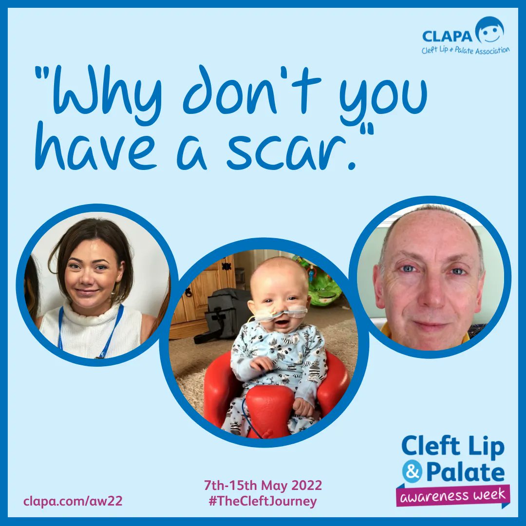 Cleft Palate Scar